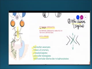734_Visual_Pathway_lesions AND ANATOMY.ppt