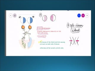 734_Visual_Pathway_lesions AND ANATOMY.ppt