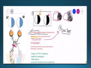 734_Visual_Pathway_lesions AND ANATOMY.ppt