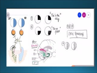 734_Visual_Pathway_lesions AND ANATOMY.ppt