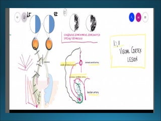 734_Visual_Pathway_lesions AND ANATOMY.ppt