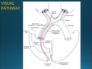 734_Visual_Pathway_lesions AND ANATOMY.ppt