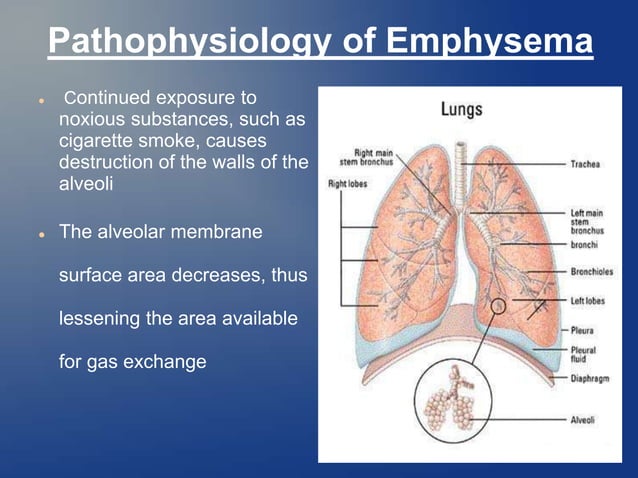 73721433-Emphysema.ppt