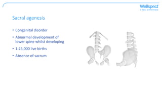 73807 usx-2104 bowel conditions in children webinar | PPT