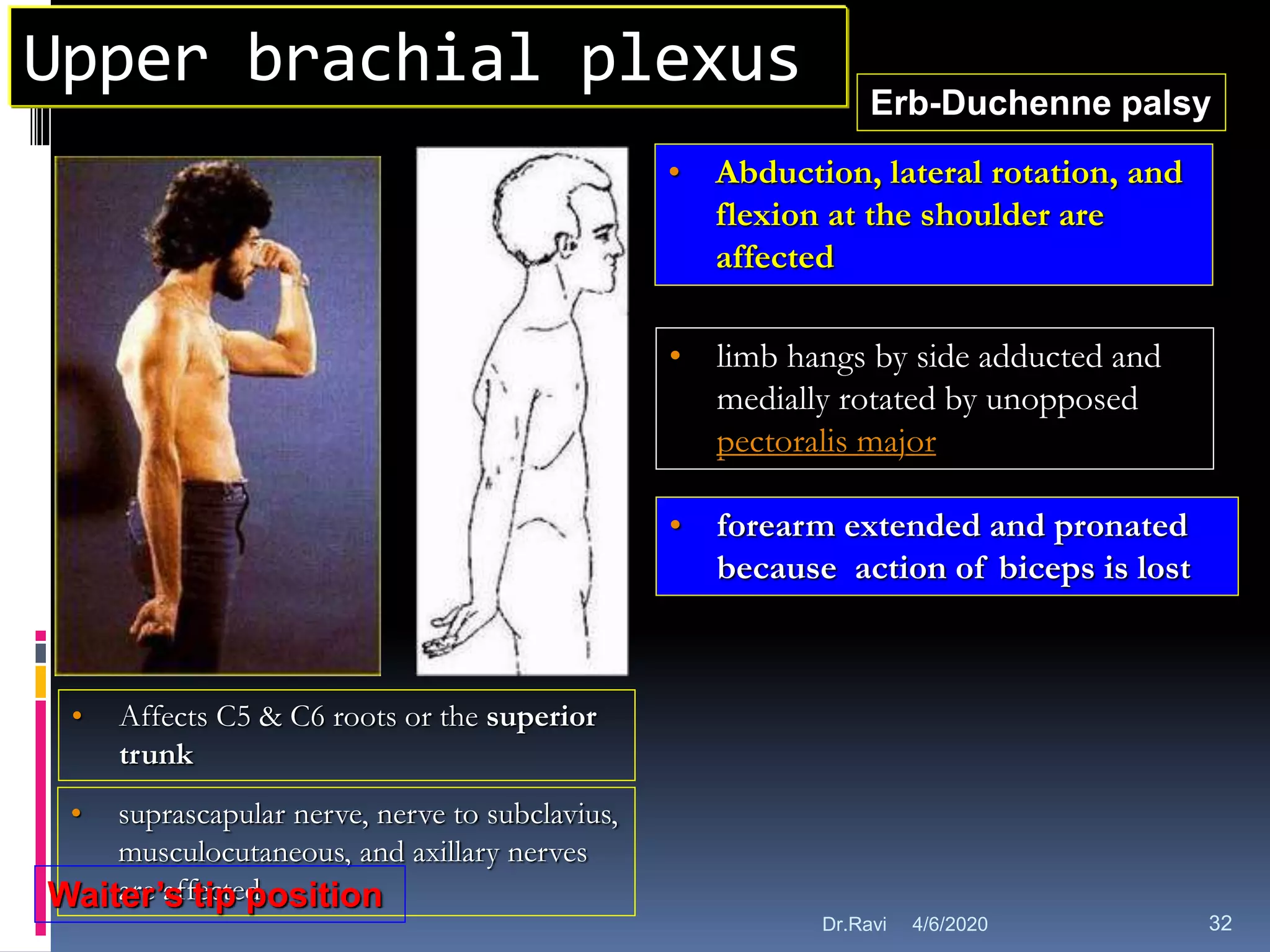 Brachial Plexus- Dr.K.S.Ravi