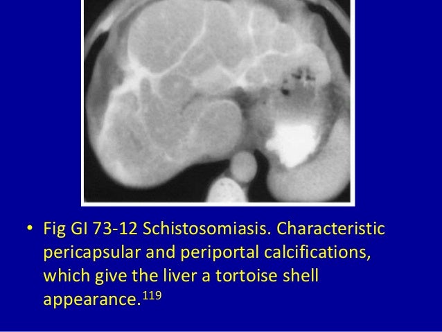 73 focal decreased attenuation masses in the liver