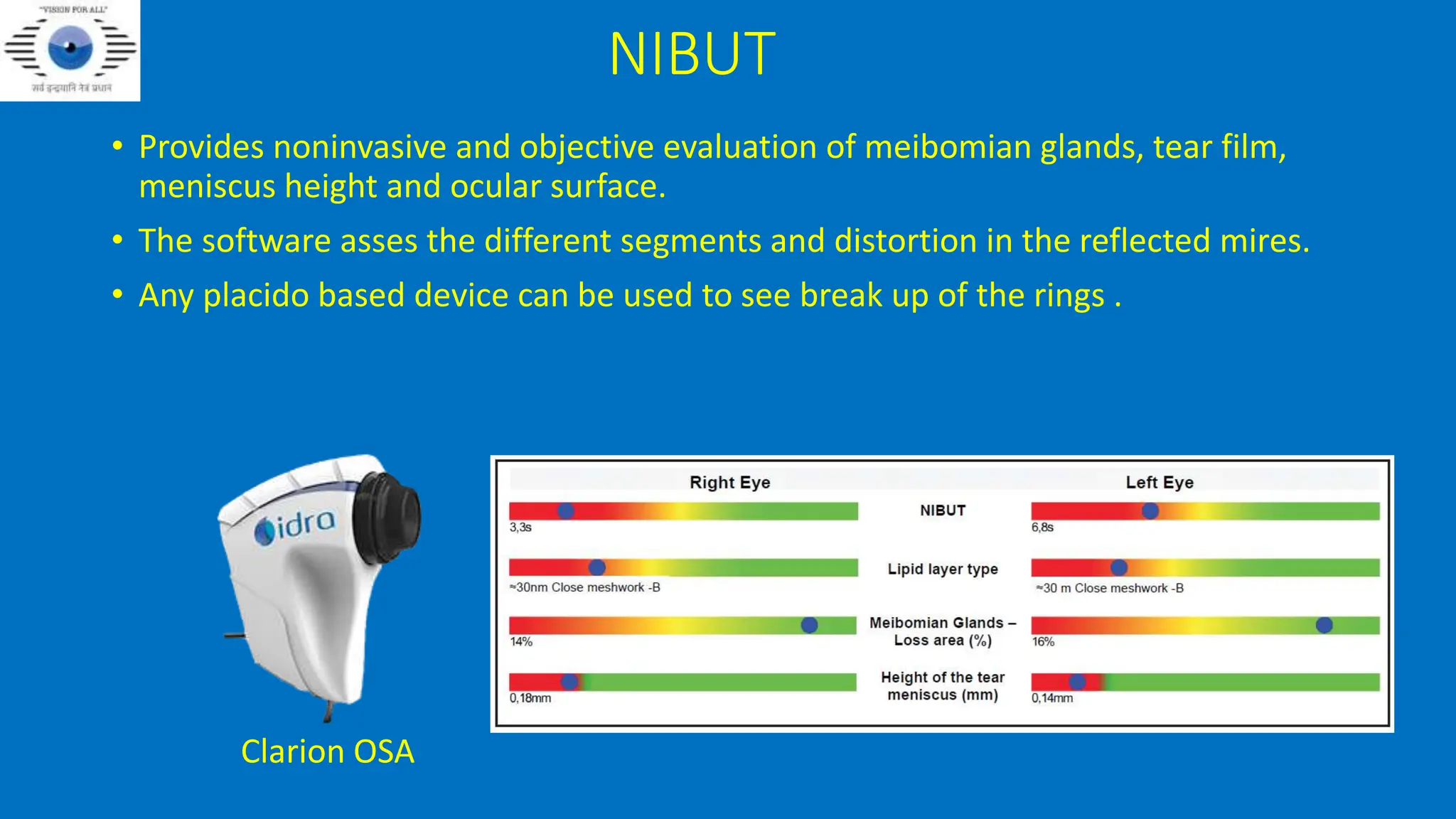 ARTIFICIAL_TEARS presentation dhir .pptx