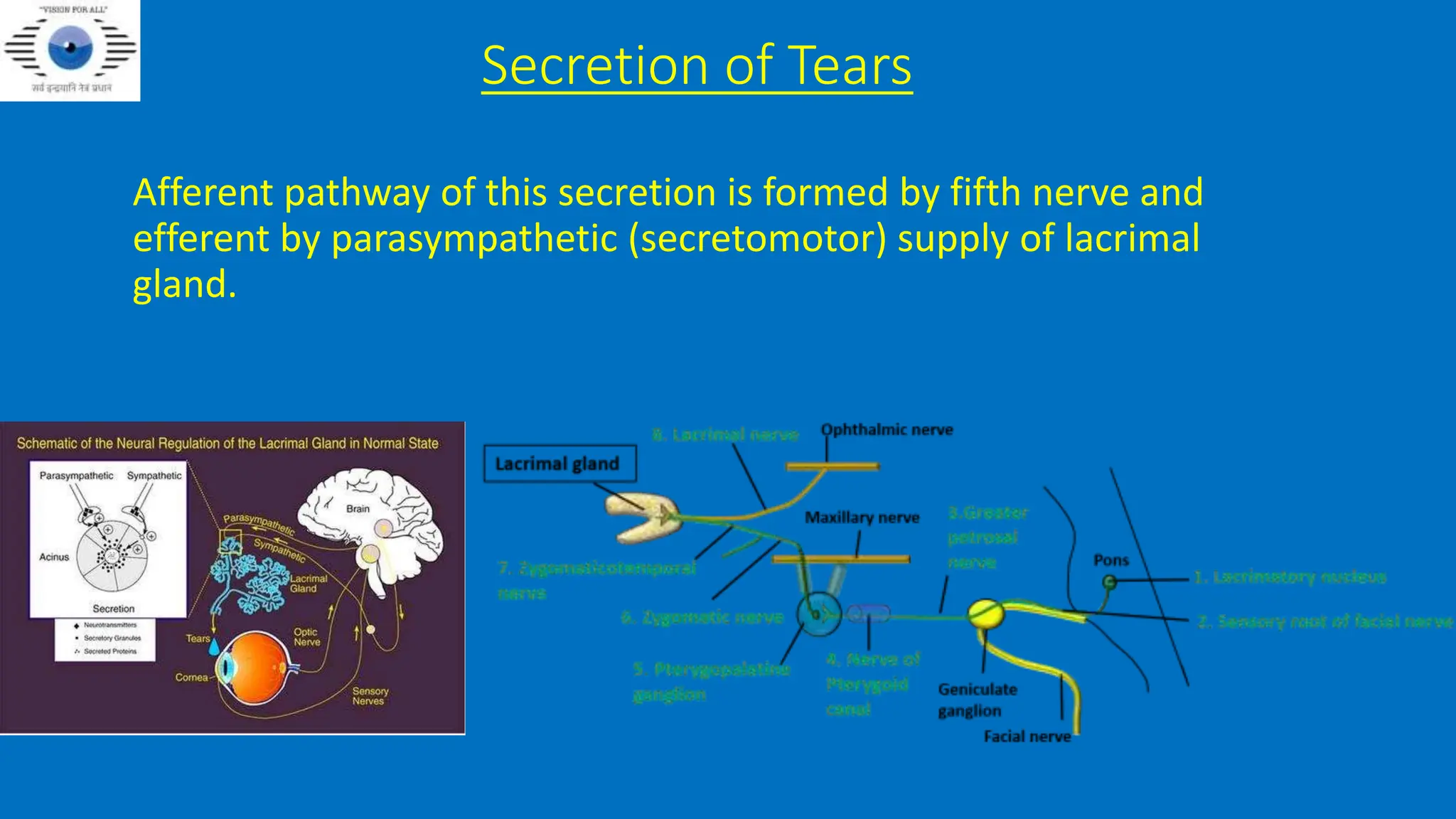ARTIFICIAL_TEARS presentation dhir .pptx
