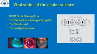 ARTIFICIAL_TEARS presentation dhir .pptx