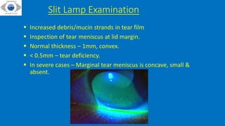 ARTIFICIAL_TEARS presentation dhir .pptx