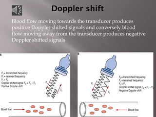 Ultrasound notes for you 740554.pptx.pptx