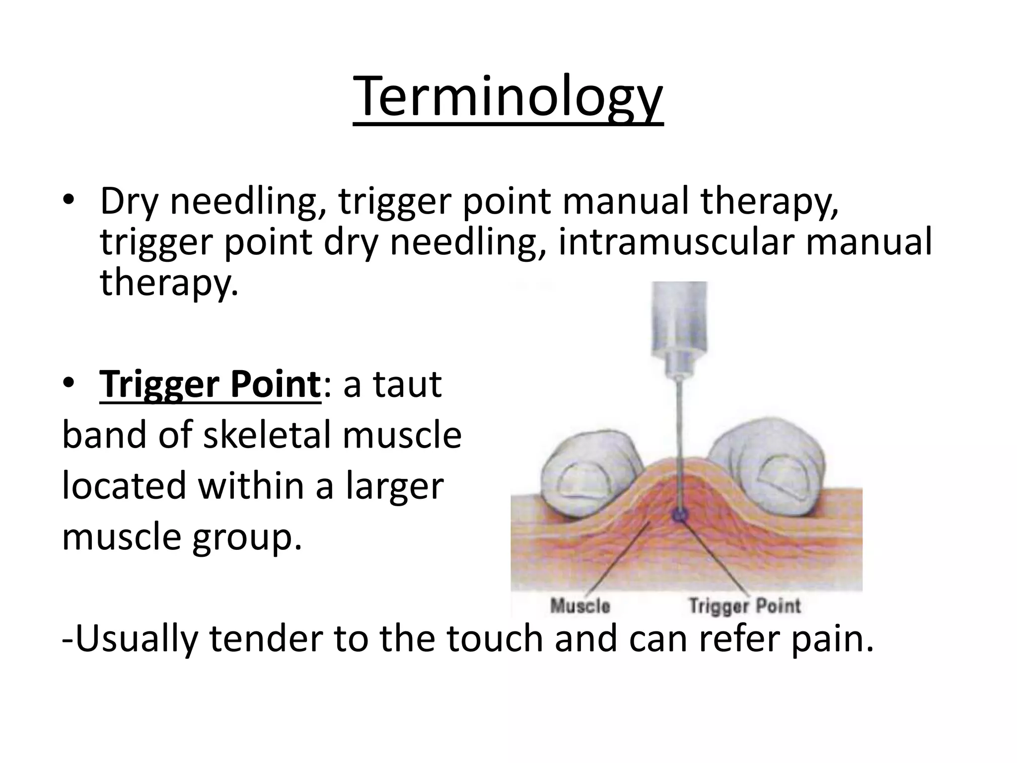 dry needling | PPTX
