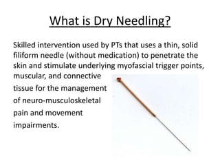 dry needling | PPTX