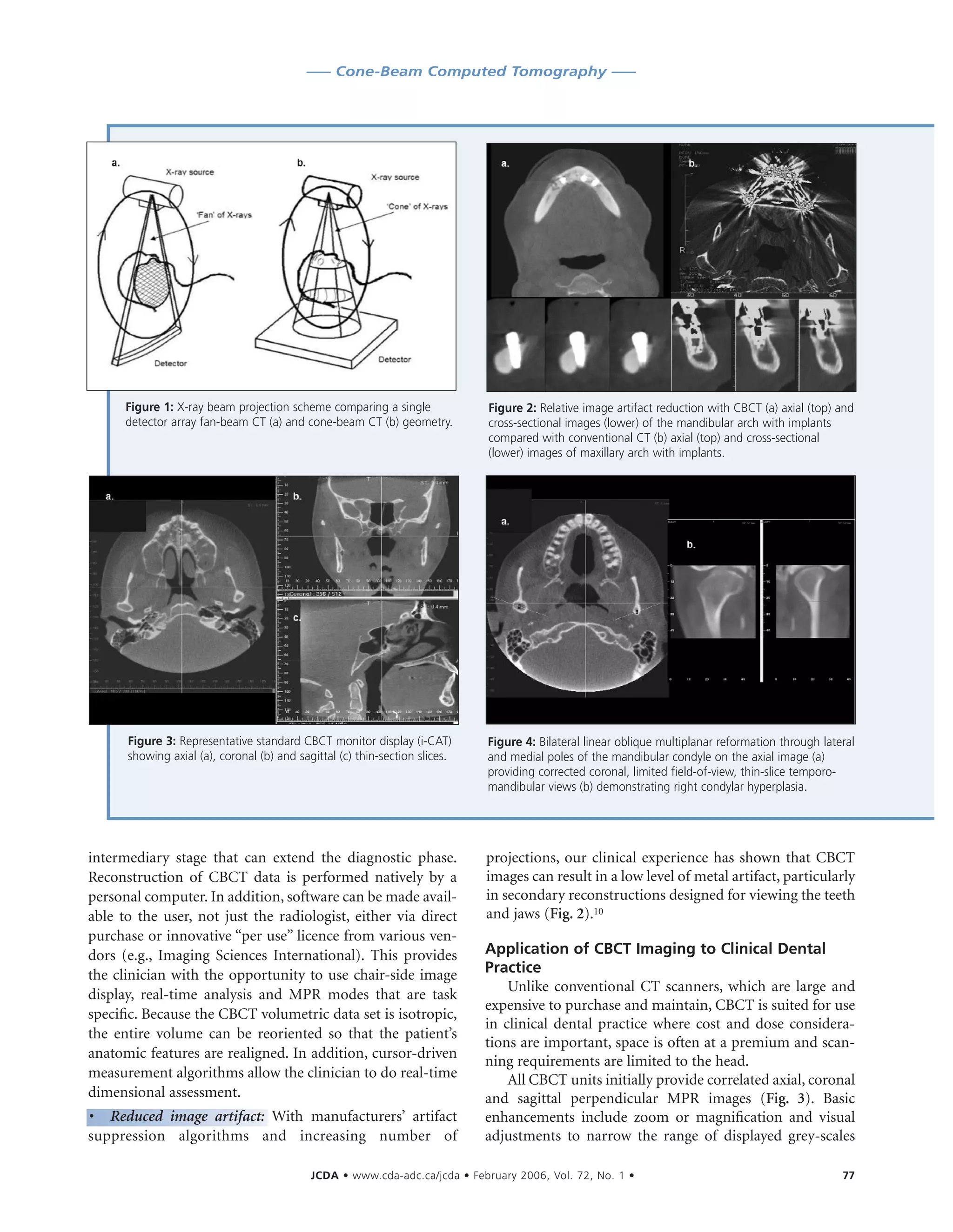 CBCT in dental practice | PDF