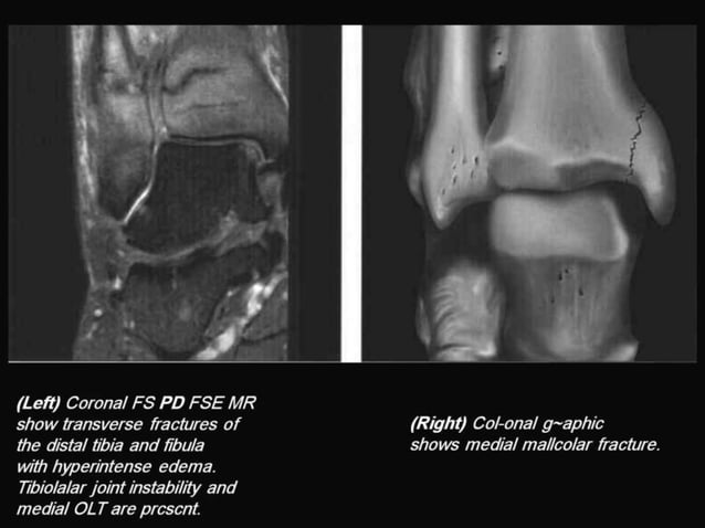 75-Dr Ahmed Esawy imaging oral board mri ankle &foot part II | PPT