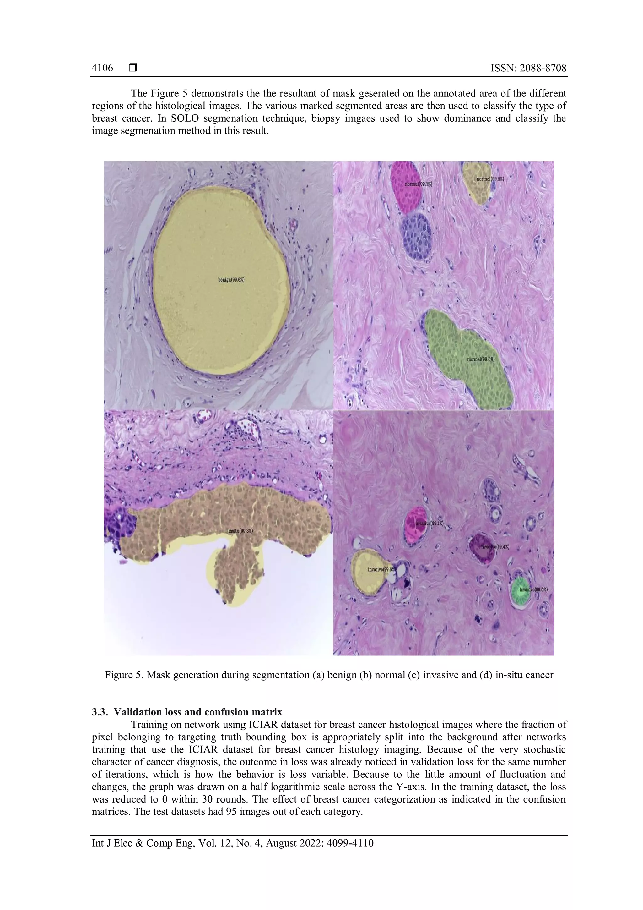 Breast cancer histological images nuclei segmentation and optimized classification with deep ...