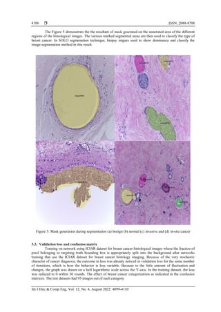 Breast cancer histological images nuclei segmentation and optimized ...