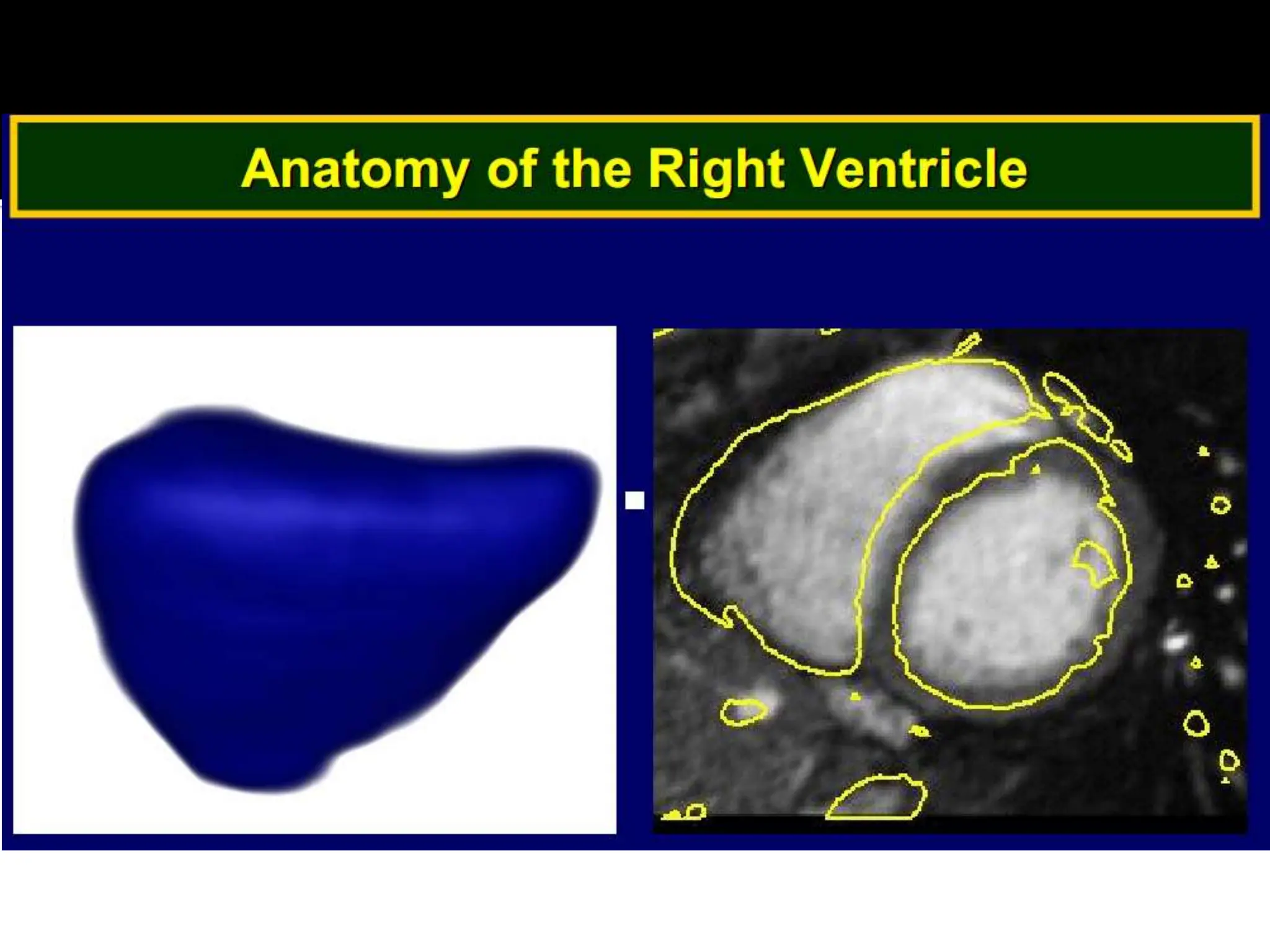 75574537-Assessment-of-Right-Ventricular-Function.ppt