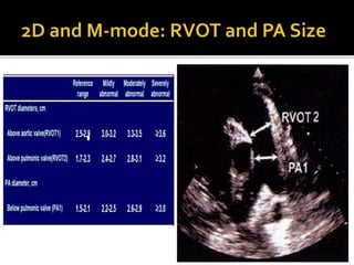 75574537-Assessment-of-Right-Ventricular-Function.ppt