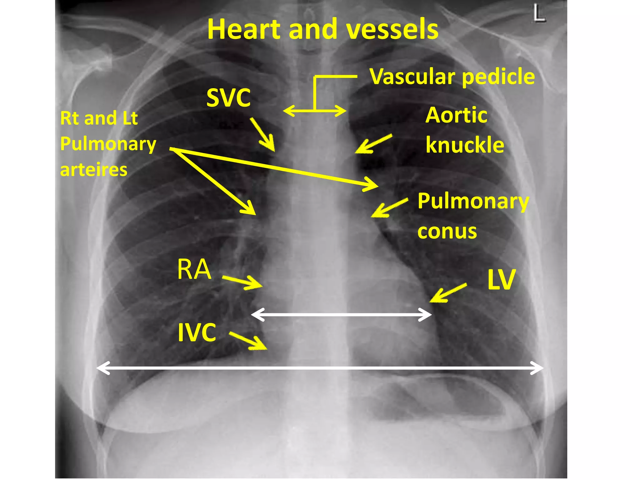 7557_interpretation-of-chest-x-ray-film.pptx