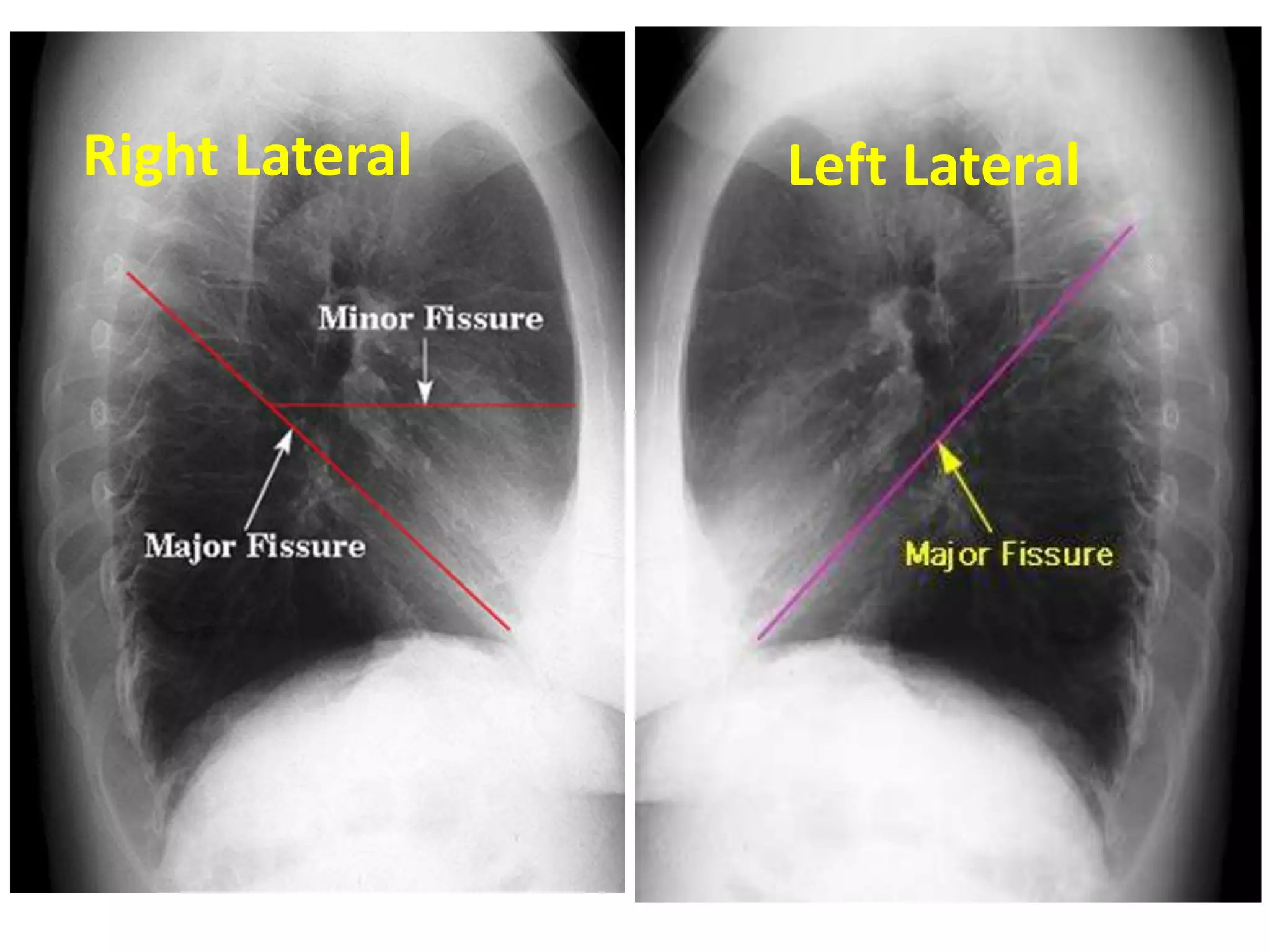 7557_interpretation-of-chest-x-ray-film.pptx