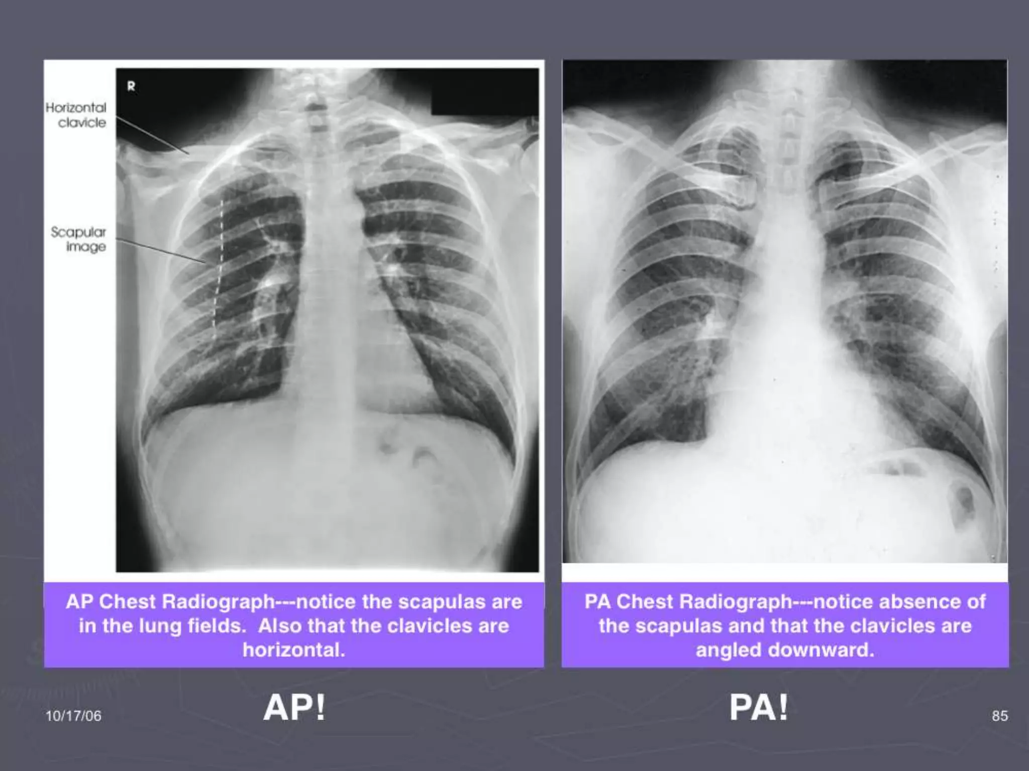 7557_interpretation-of-chest-x-ray-film.pptx