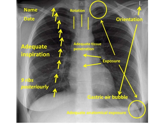 7557_interpretation-of-chest-x-ray-film.pptx