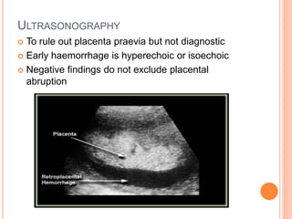 ABRUPTIO PLACENTAE (2) with animation | PPTX