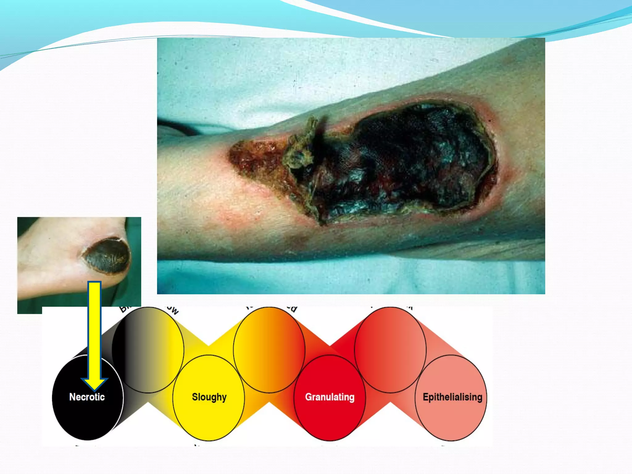 Bedside Procedures | PPT