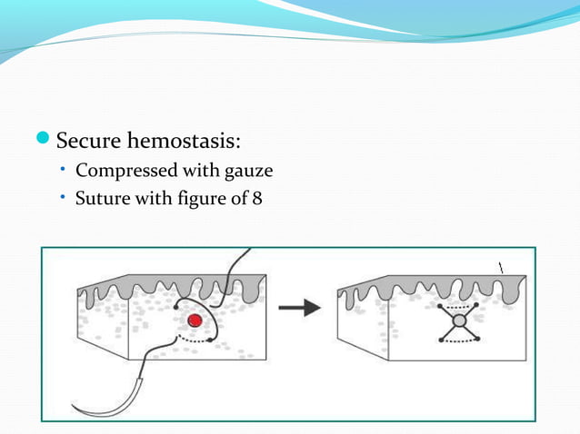 Bedside Procedures | PPT