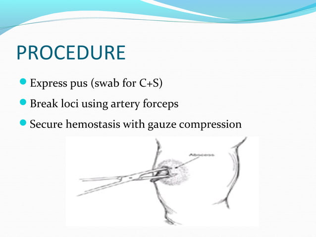 Bedside Procedures | PPT