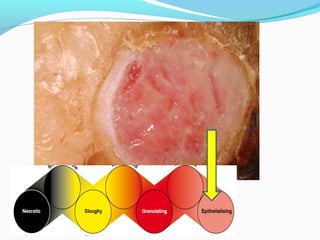 Bedside Procedures | PPT