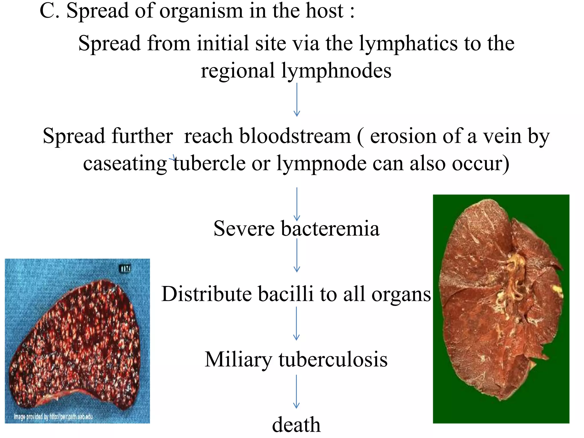 Mycobacterium tuberculosis | PPTX