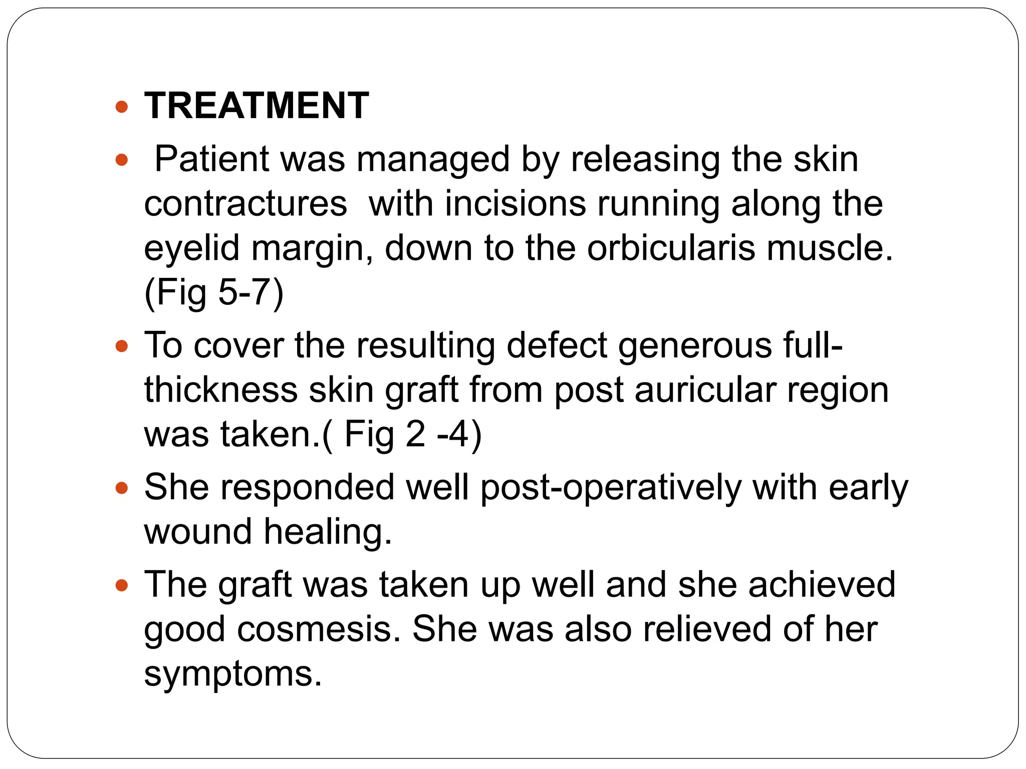Full Thickness Skin Graft In Cicatricial Ectropion | PPTX