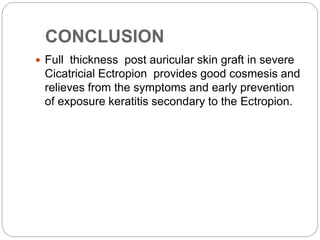 Full Thickness Skin Graft In Cicatricial Ectropion | PPTX