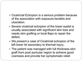 Full Thickness Skin Graft In Cicatricial Ectropion | PPTX