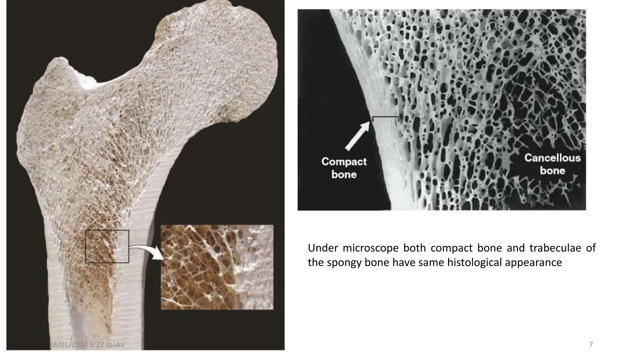 76. General Anatomy of Bone.pptx........ | PPTX