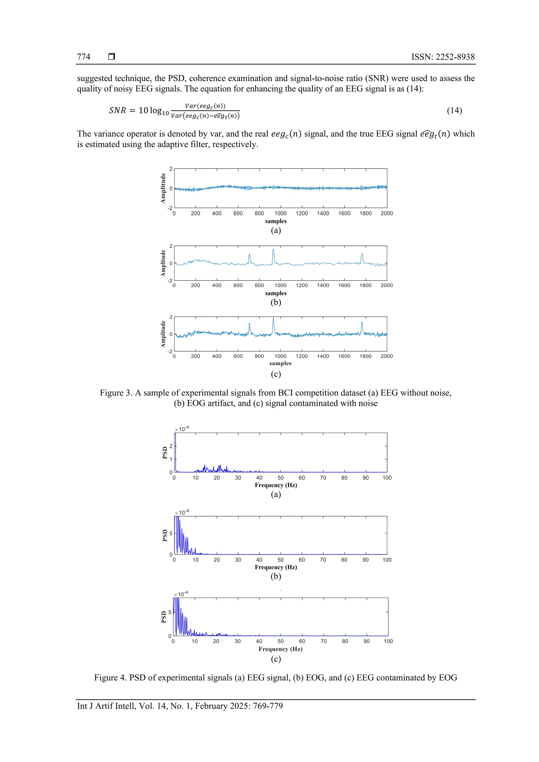 Electroencephalogram denoising using discrete wavelet transform and ...