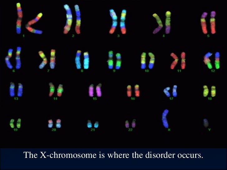Duchenne Muscular Dystrophy (DMD)