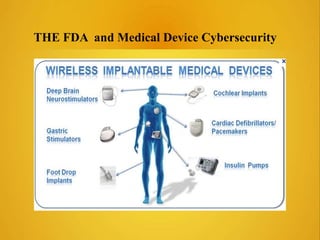 THE FDA and Medical Device Cybersecurity Guidance | PPTX