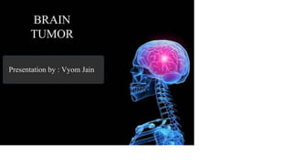 brain tumor.pptx