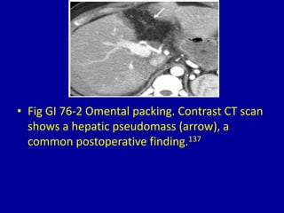 76 fatty lesions of the liver | PPTX