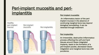 periimplantitis.pptx. . | PPTX
