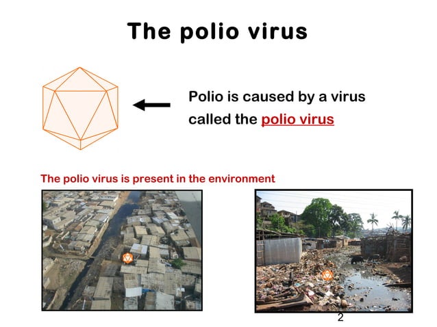 Polio pathophysiology | PPS