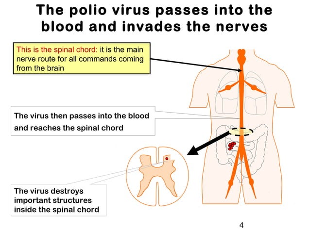 Polio pathophysiology | PPS