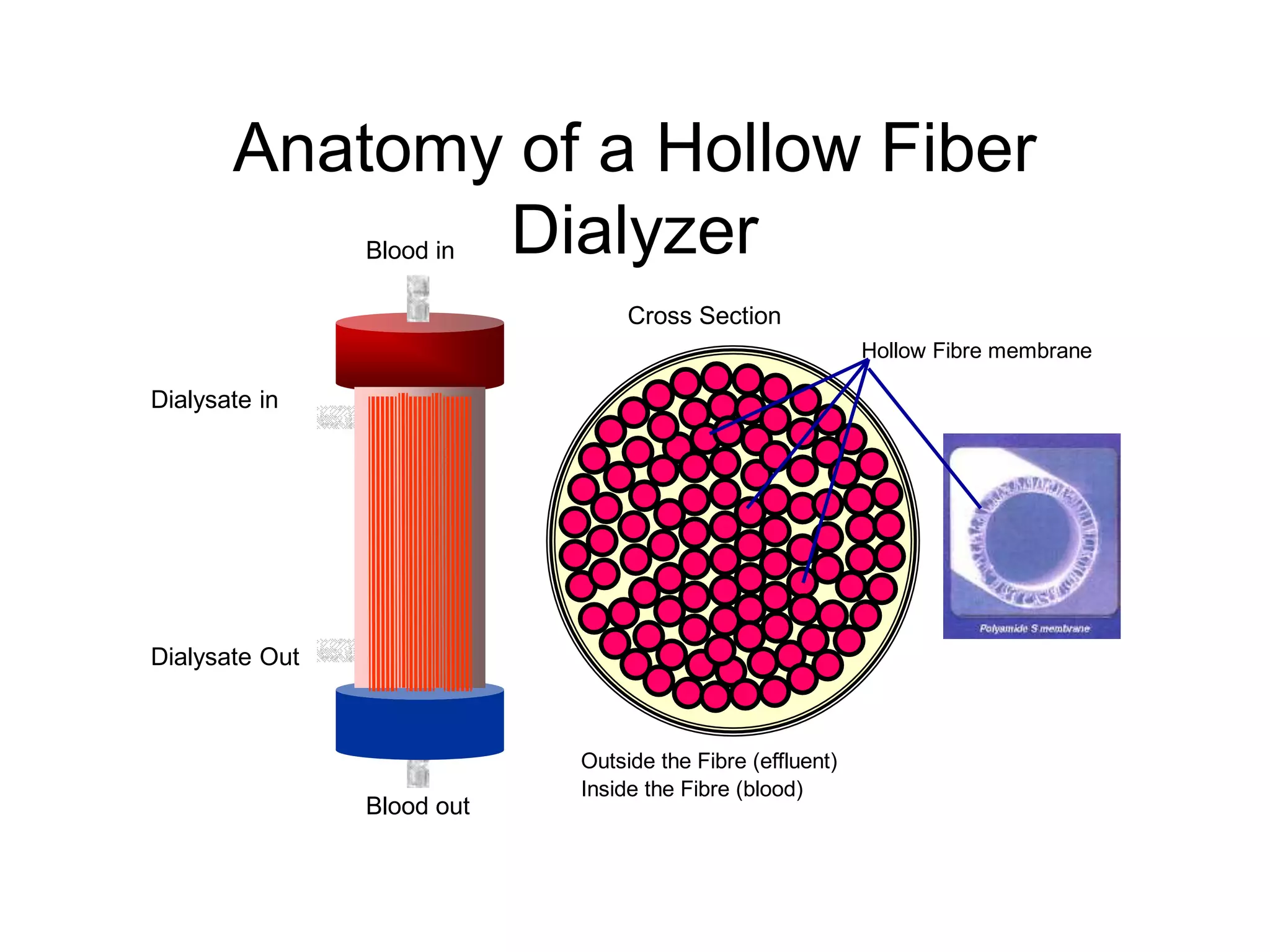 DIALYZER.ppt