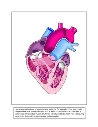 heart diagram | DOCX