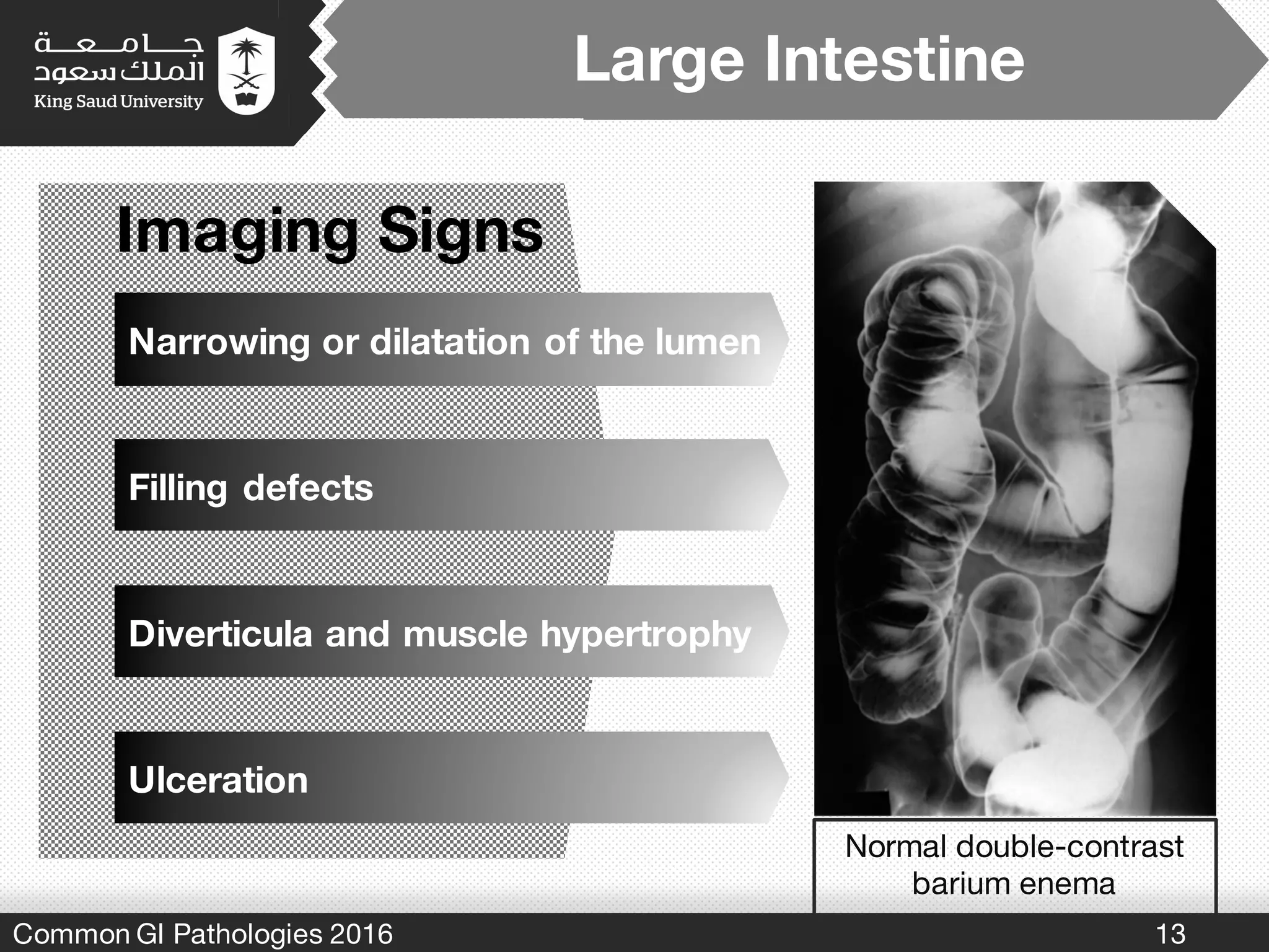 Common GI Pathologies | PDF