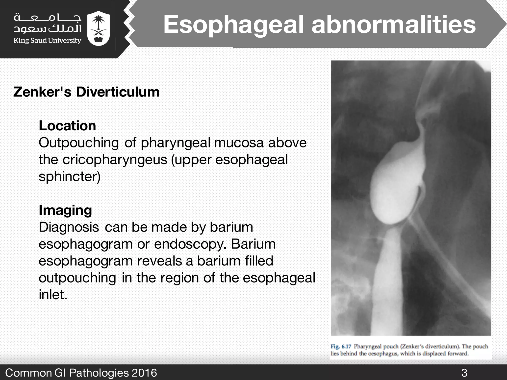 Common GI Pathologies | PDF
