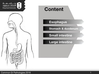 Common GI Pathologies | PDF